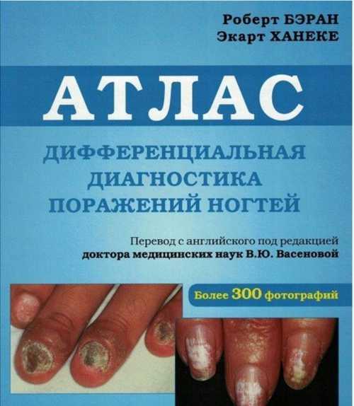 Атлас дифференциальная диагностика поражения ногте