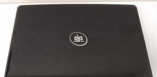 Корпус для ноутбука DNS A17HC (0138075)