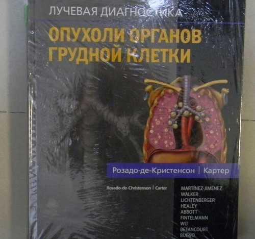 Лучевая диагностика. Опухоли грудной клетки. книга
