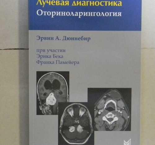 Лучевая диагностика.Оториноларингология.Дюннебир