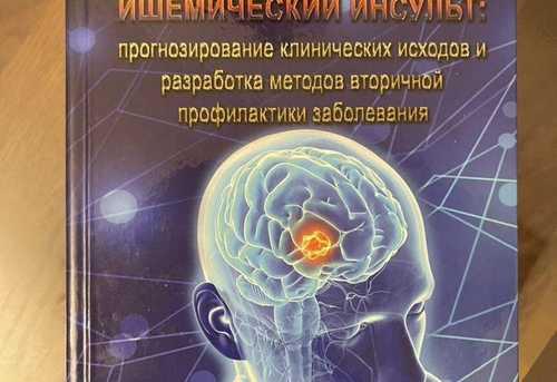 Ишемический инсульт Калёнова И.Е