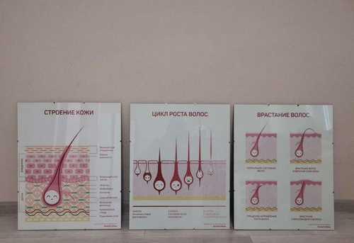 Плакаты в кабинет мастера депиляции с рамками