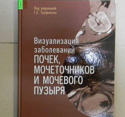 Визуализация заболеваний почек, мочеточников и моч