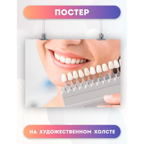 Постер на холсте Стоматология Виниры (8) 30х40 см