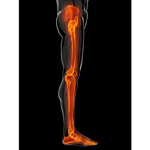 Постер А3 Рентген нога. фотоглянец