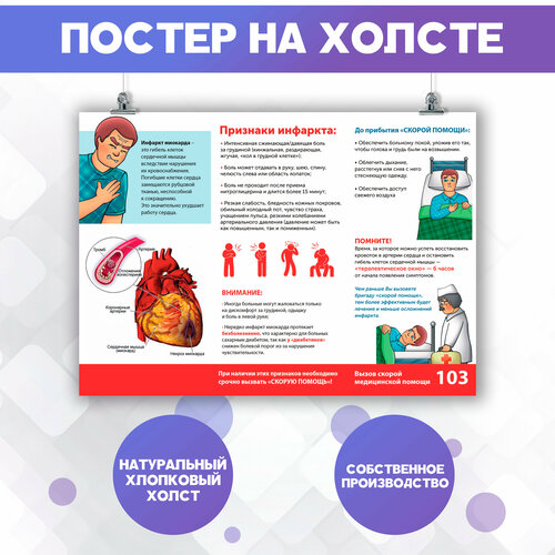 Постер на холсте Инфаркт, болезни сердца, медицина 40х60 см