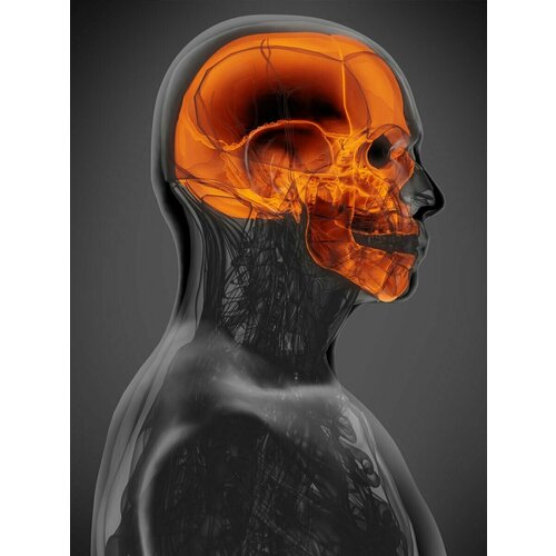 Постер А3 Рентген череп. фотоглянец