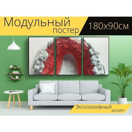 Модульный постер "Дантист, ортодонтия, зубная шина" 180 x 90 см. для интерьера
