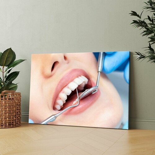 Картина на холсте (Женщина проверяет зубы у стоматолога) 40x60 см. Интерьерная, на стену.