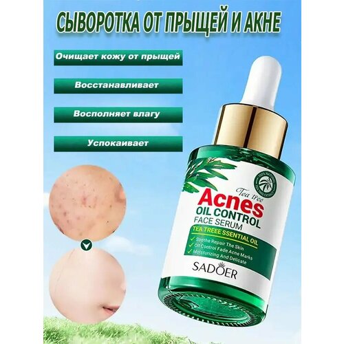 Сыворотка для лица "Против акне и прыщей" 30мл