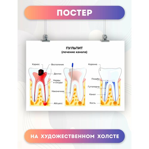 Постер на холсте Стоматология зубной врач анатомия (11) 60х80 см