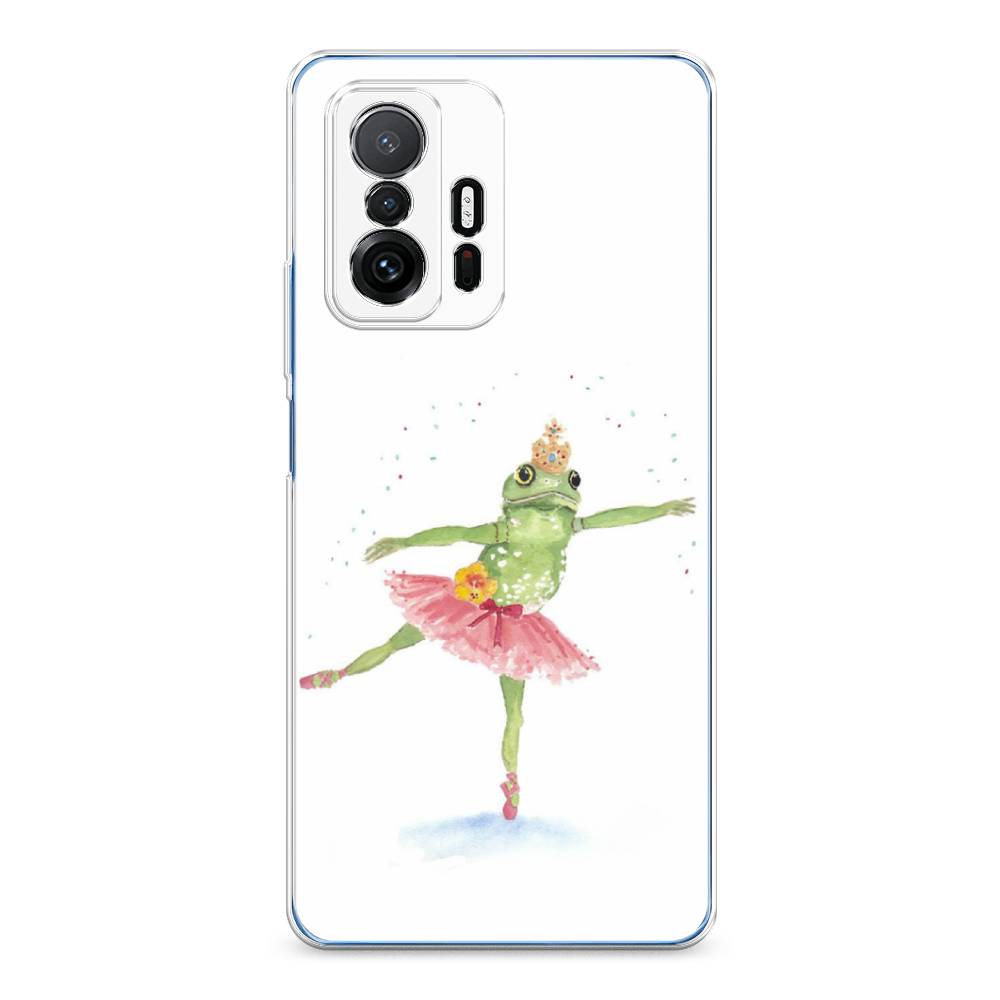 Чехол на Xiaomi Mi 11T/11T Pro "Лягушка-балерина"
